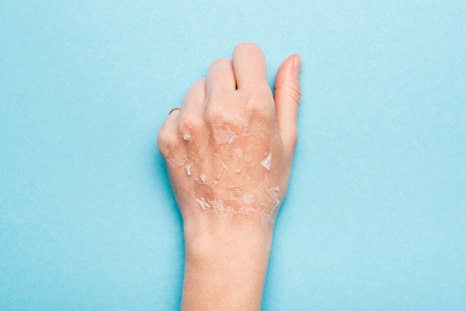Dry and Itchy Skin ( English-Speaking Dermatologist in Taiwan ...